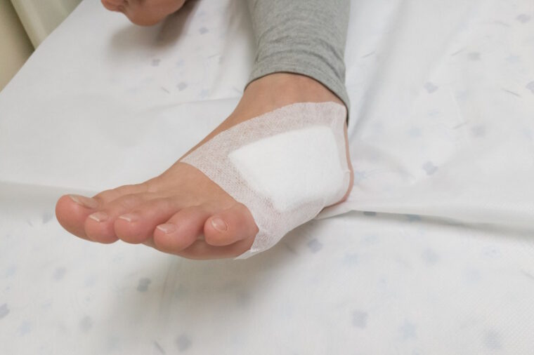 Cat Bite Infections: 13 Critical Vet-Approved Signs to Watch For ...