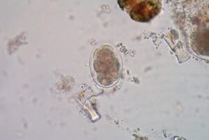 Hookworms in Dogs: Our Vet Explains Signs, Causes, & Treatment | Hepper ...