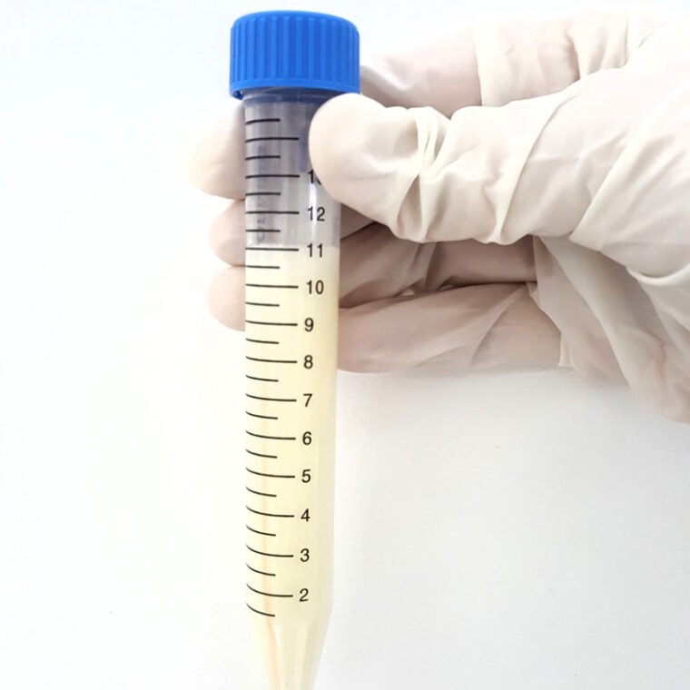 Rabbit Urine Color Guide: Vet-Verified Causes & Recommendations ...