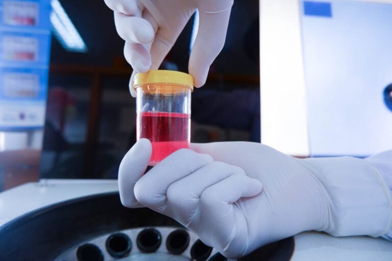 Rabbit Urine Color Guide: Vet-Verified Causes & Recommendations ...