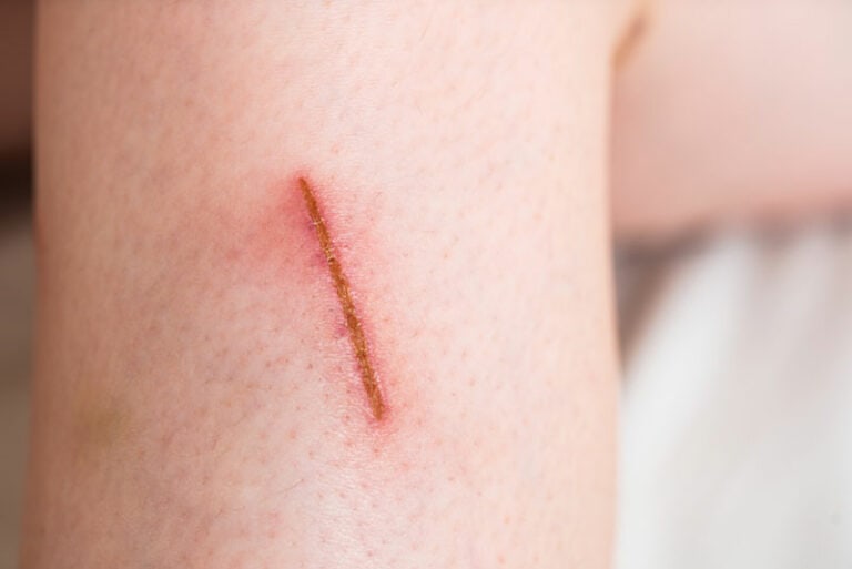 Why Are Cat Scratches Itchy? 4 Vet-Explained Reasons | Hepper Pet Resources